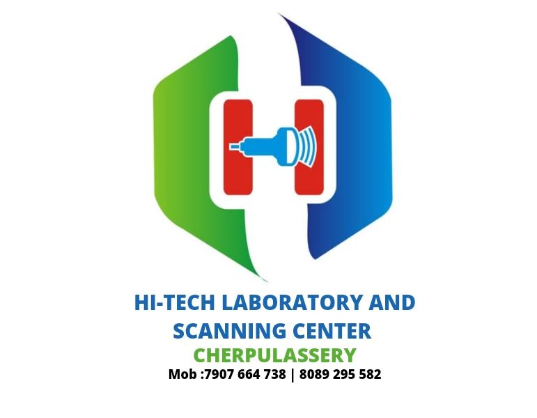 HI-TECH LABORATORY AND SCANNING CENTER AND X RAY CHERPULASSERY ...